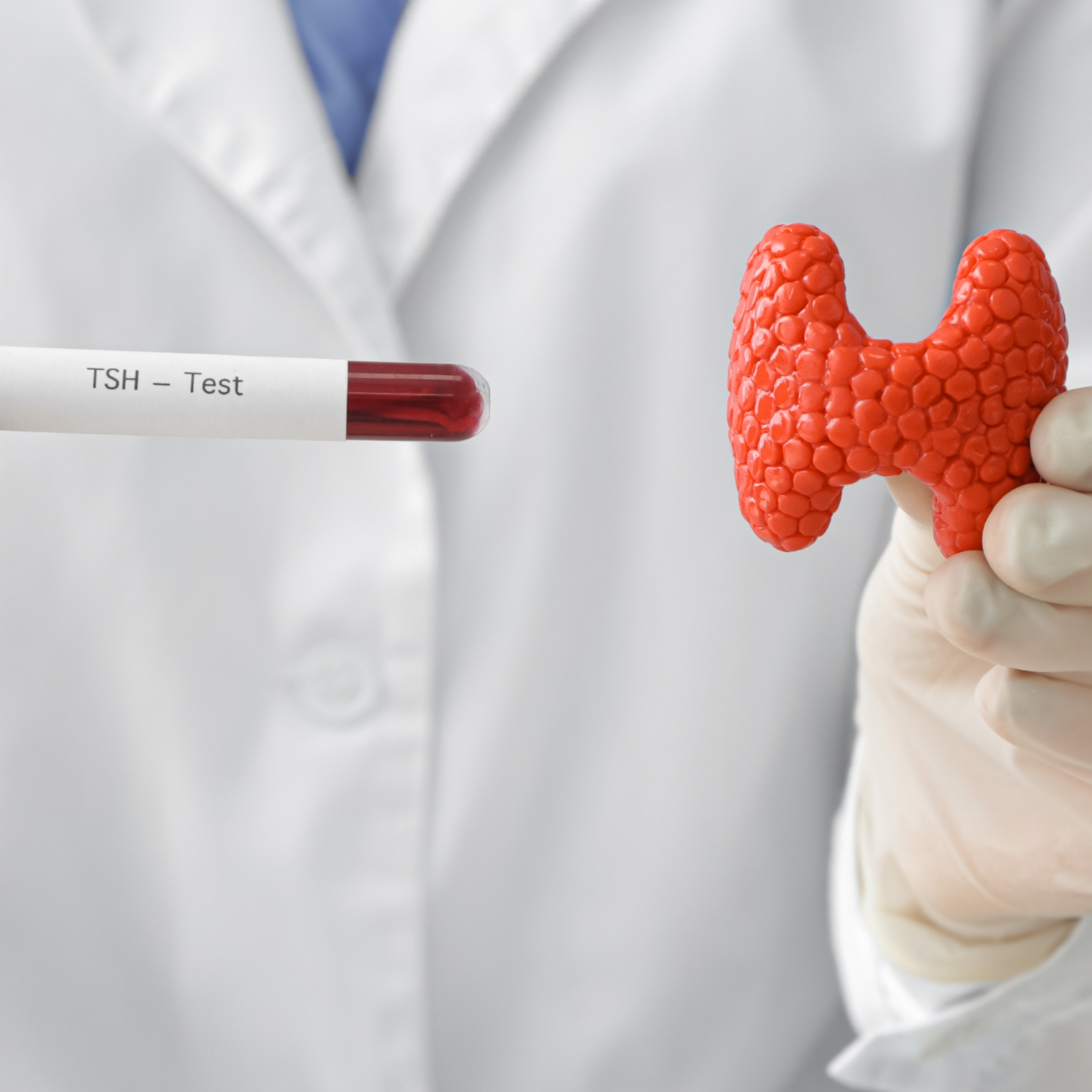Analisi Tiroide - F-Medical Group