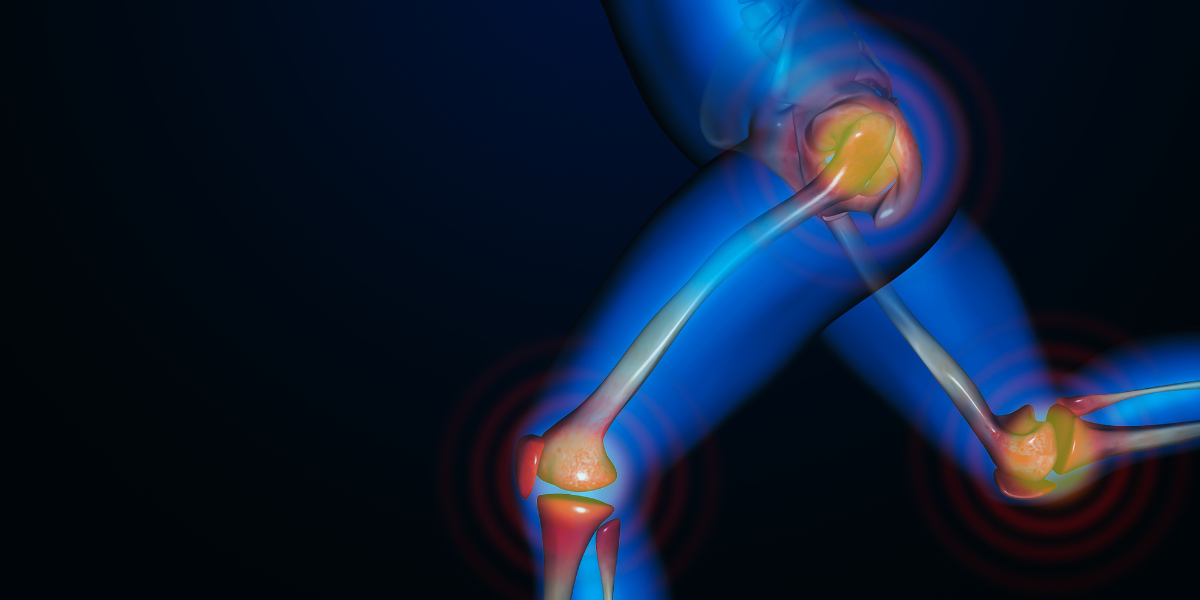 Fratture del femore (femore rotto): vediamo insieme come intervenire ...